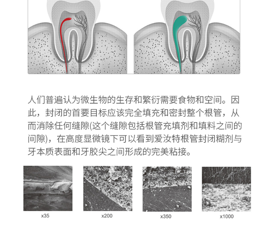 爱汝特 SP生物陶瓷根管封闭糊剂（充填）、加拿大爱汝特、爱如特，iroot，root,IRSP 08 K1-1，根管水泥,4390003001 ...