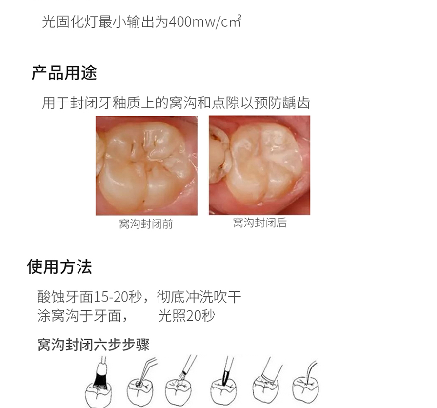 3M 光固化窝沟封闭剂白色补充装1930W# 6ml、美国3M、1930W（6ml/瓶）,0030168001,C0710011470100104864-牙e在线 牙科综合性服务型电商平台